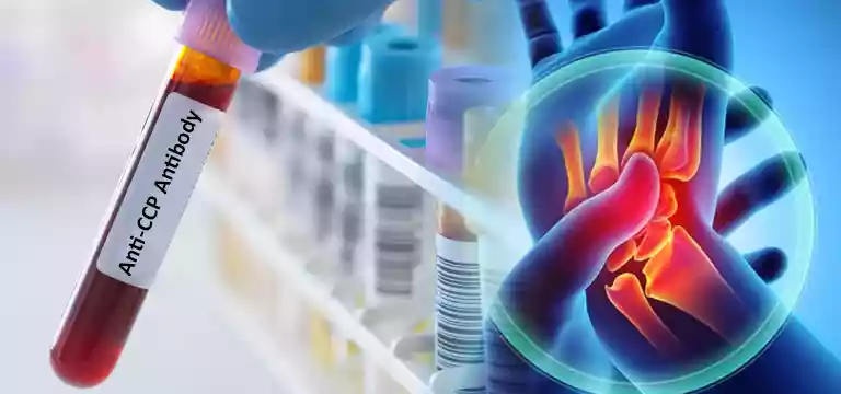Anti-CCP Antibody Test : A Complete Guide Regarding Test, Procedure ...