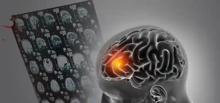 Evaluating Traumatic Brain Injuries with PET Scans: Diagnostic ...