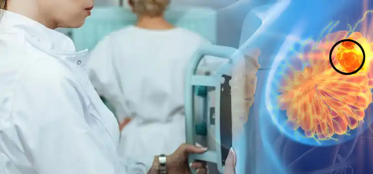 Role of PET scan in Breast Cancer Treatment | Ganesh Diagnostic