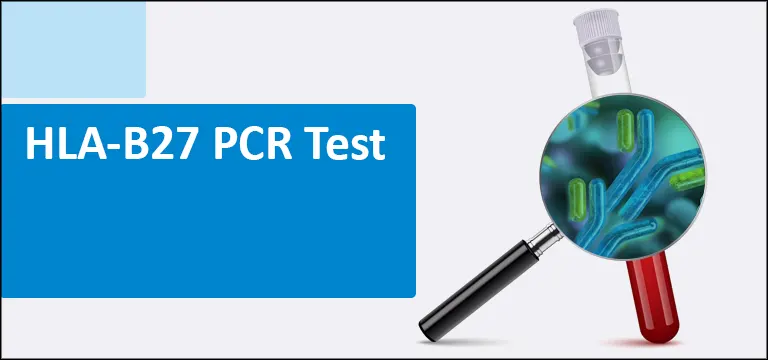 What is HLA-B27 PCR Test: Uses, Procedure, Precautions and Test Price