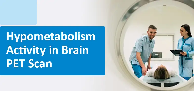 Hypometabolism Activity in Brain PET Scan