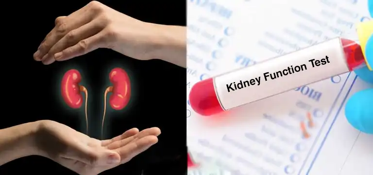 Overview of Kidney Function Test: Purpose, Preparation, Procedure ...