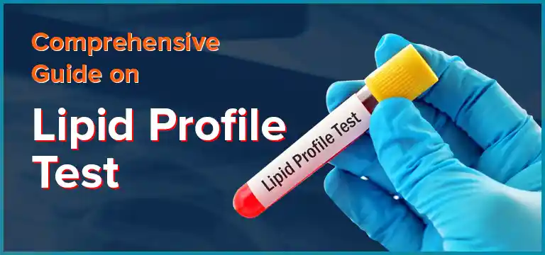 Comprehensive Guide on Lipid Profile Test | Ganesh Diagnostic