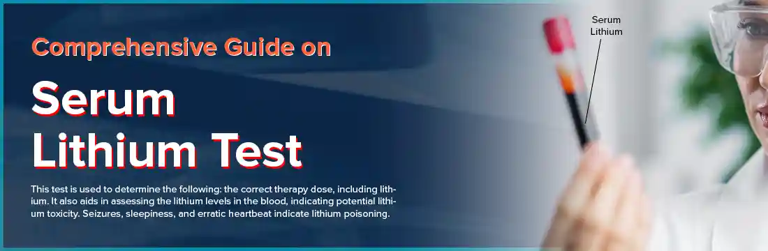 Comprehensive Guide on Serum Lithium Test | Ganesh Diagnostic