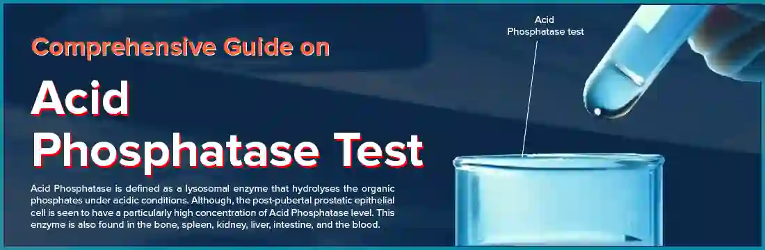 Comprehensive Guide on Acid Phosphatase Test | Ganesh Diagnostic