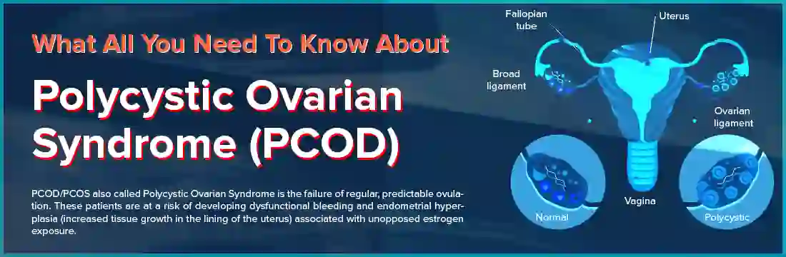 What All You Need To Know About PCOD | Ganesh Diagnostic