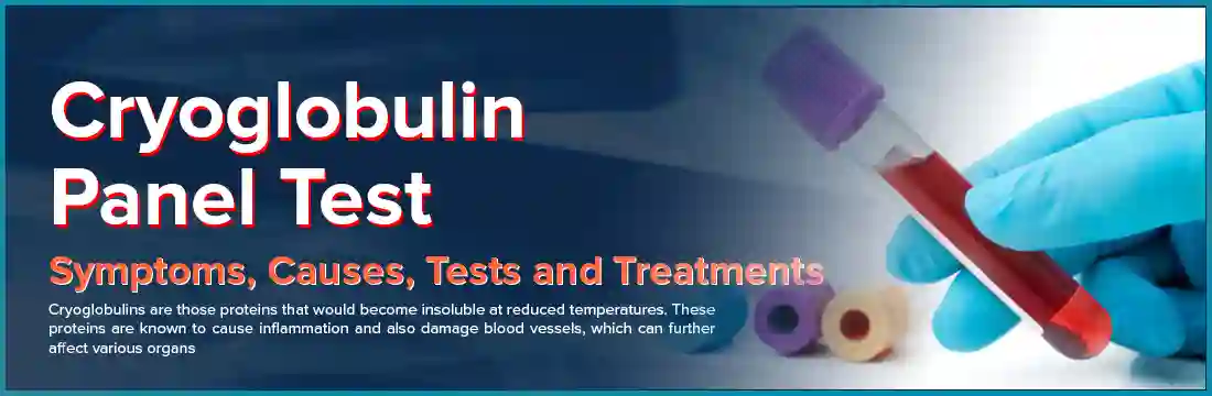 Cryoglobulin Panel Test: Symptoms, Causes, Tests and Treatments