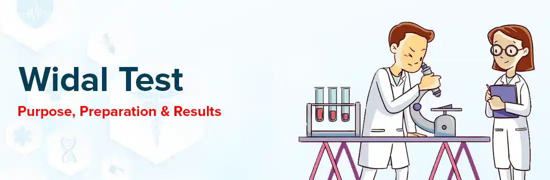 Widal Test for Typhoid Fever: Purpose, Preparation, Procedure and Results