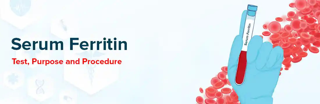Significance Of Serum Ferritin Test : Purpose and Procedure | Ganesh ...