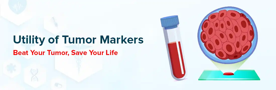 Utility Of Tumor Markers: Beat Your Tumor, Save Your Life | Ganesh ...
