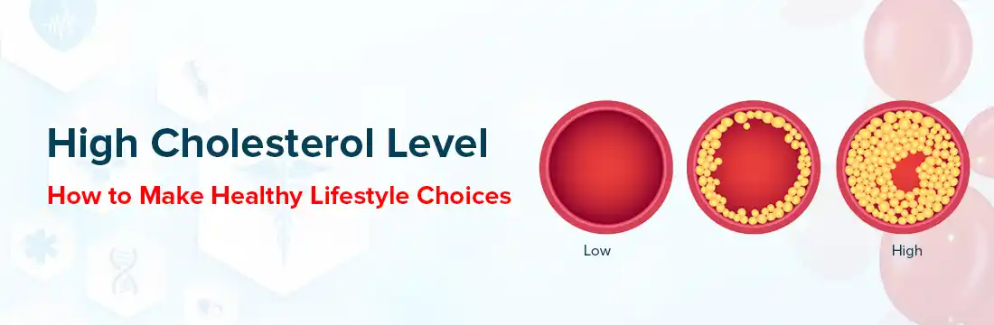 High Cholesterol Level: How to Make Healthy Lifestyle Choices | Ganesh ...