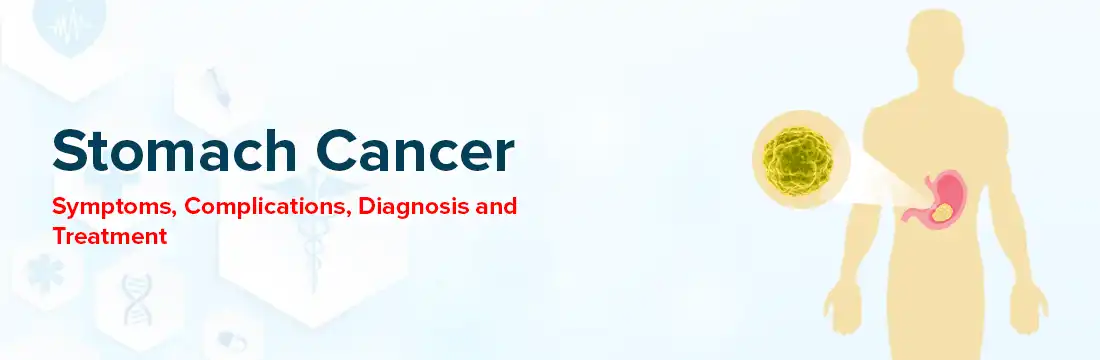 Stomach Cancer : Symptoms, Complications, Diagnosis and Treatment