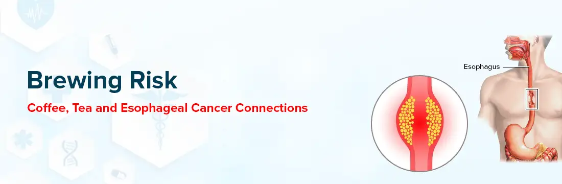Brewing Risk: Coffee, Tea and Esophageal Cancer Connections