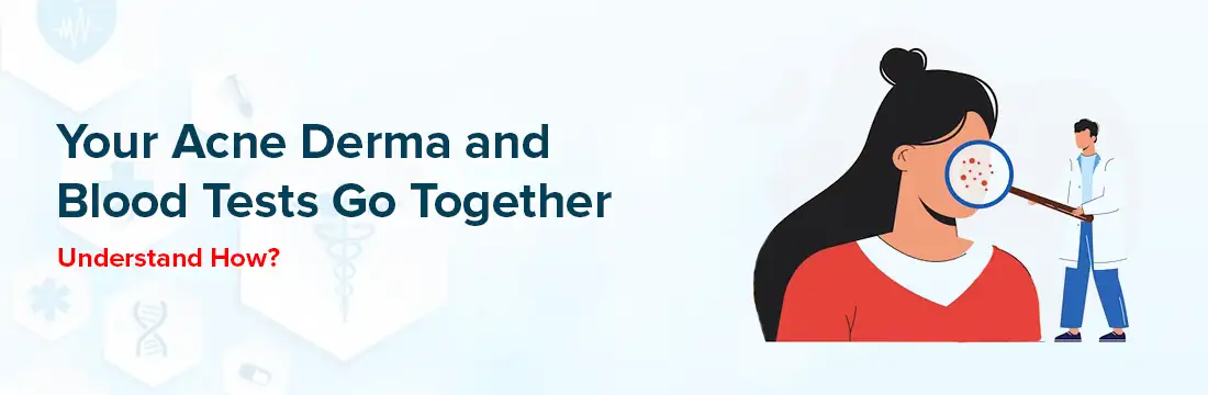 Your Acne Derma and Blood Tests Go Together, Understand How? | Ganesh ...