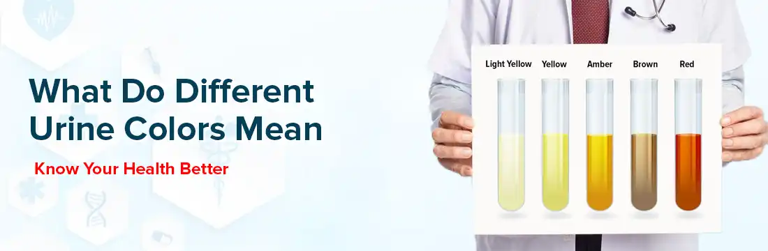 What Do Different Urine Colors Mean? Know Your Health Better | Ganesh ...