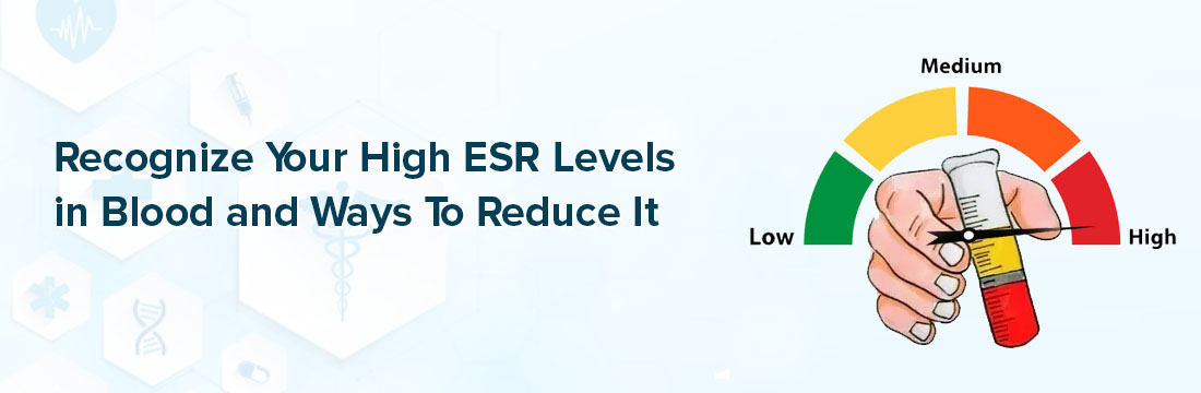Recognize Your High ESR Levels in Blood and Ways To Reduce It | Ganesh ...