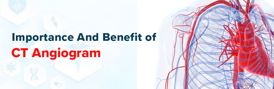 Importance and Benefit of CT Angiogram | Ganesh Diagnostic