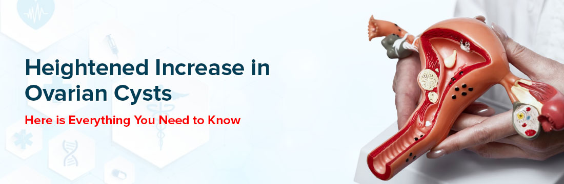 Heightened Increase in Ovarian Cysts: Here is Everything You Need To ...