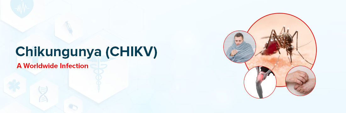 Chikungunya (CHIKV)- A Worldwide Infection | Ganesh Diagnostic