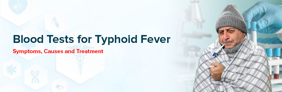 Blood Tests For Typhoid Fever: Symptoms, Causes and Treatment | Ganesh ...