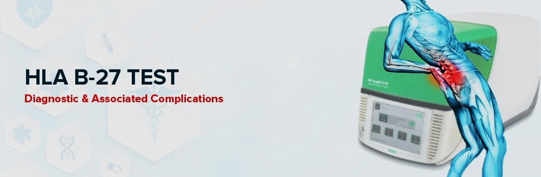 The HLA-B27 Test: Diagnosis and Associated Complication | Ganesh Diagnostic