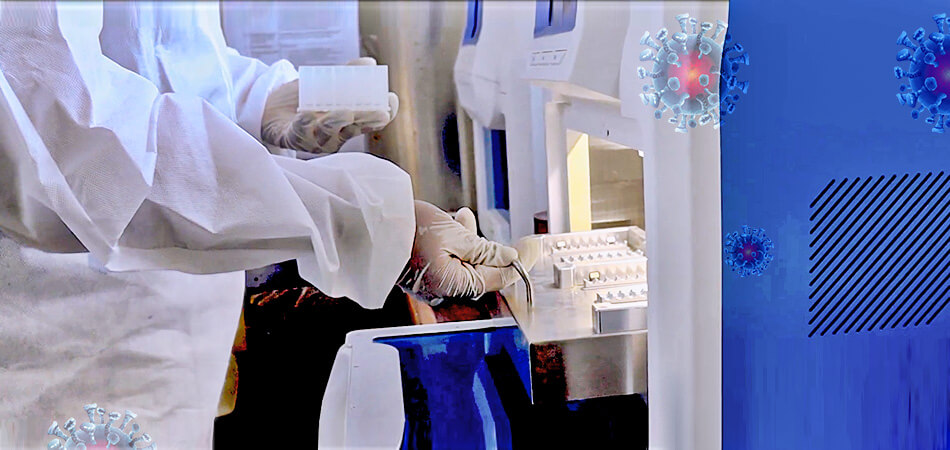 Confirmation of Sars-CoV2 (Covid-19) by Latest Molecular-based PCR (RT ...