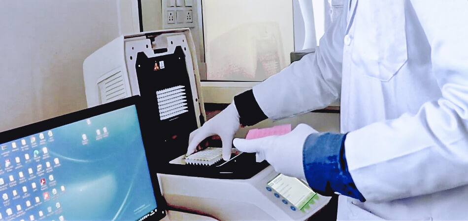 Test For Diagnosing Hepatitis C Virus RNA by PCR, Quantitative | Ganesh ...