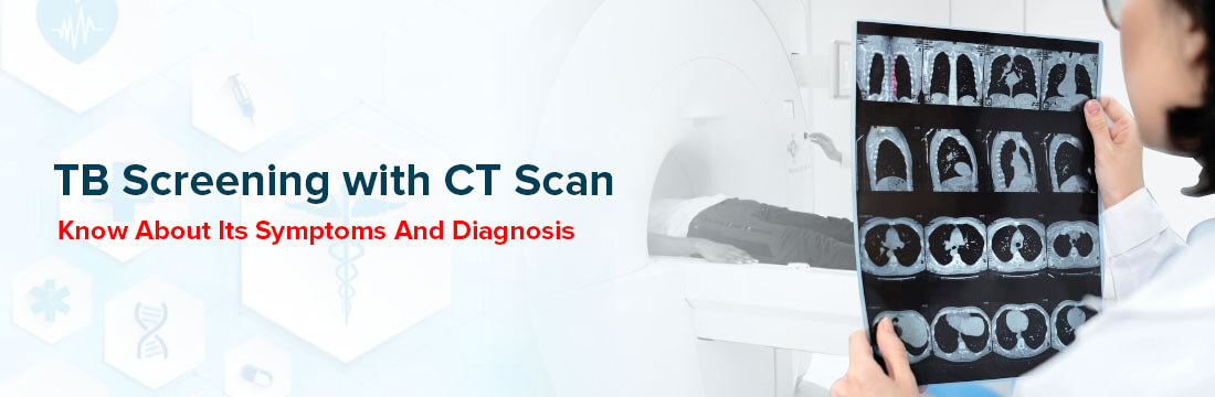 TB Screening With CT Scan | Know About Its Symptoms and Diagnosis of TB