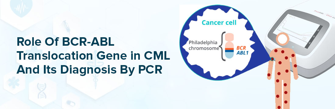 Role of BCR ABL Translocation Gene in CML and Its Diagnosis By PCR