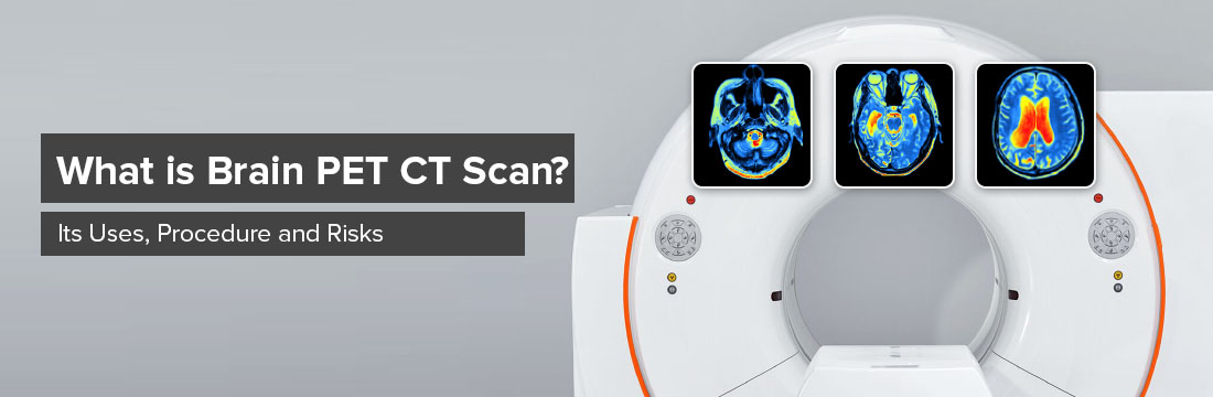 Brain PET CT Scan | Its Uses, Procedure and Risks