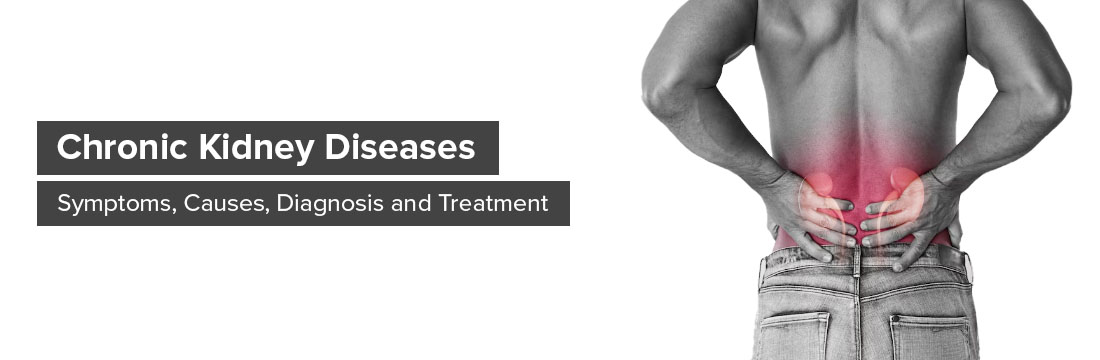 Chronic Kidney Diseases : Symptoms, Causes, Diagnosis and Treatment