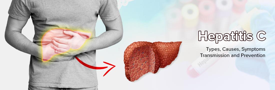 Hepatitis C: Types, Causes, Symptoms, Transmission and Prevention ...