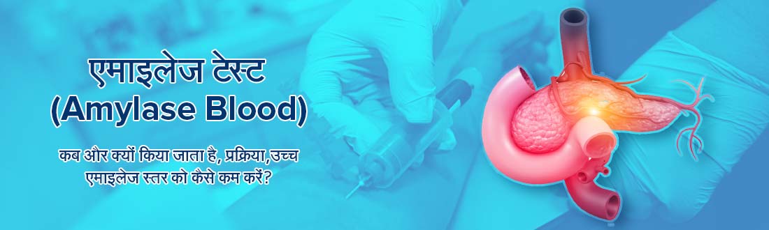 एमाइलेज टेस्ट: कब और क्यों किया जाता है, प्रक्रिया, उच्च एमाइलेज स्तर ...