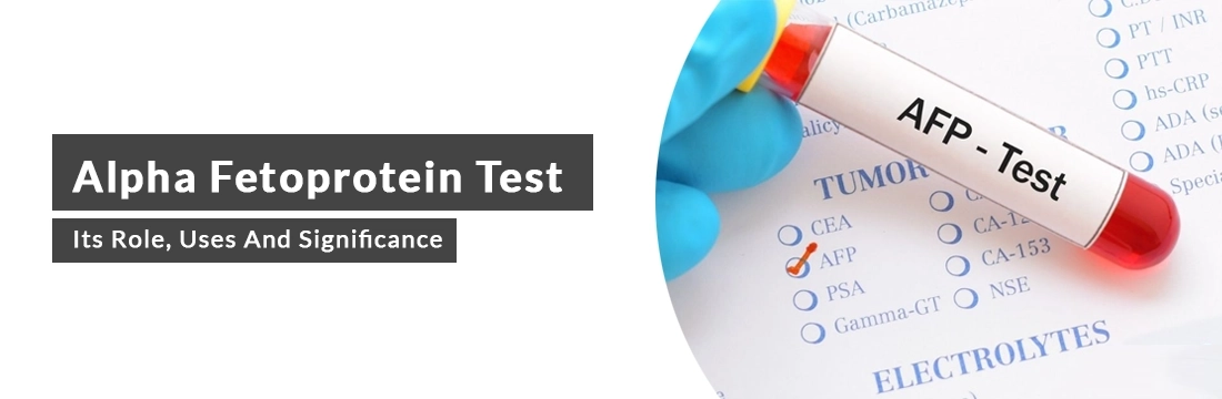Alpha Fetoprotein Test With Its Role Uses And Significance