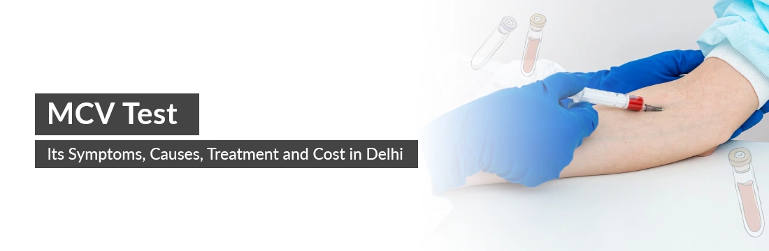 MCV Test: Its Symptoms, Causes, Treatment and Cost in Delhi