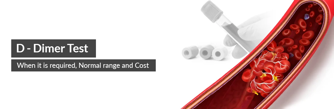 D - Dimer Test: When it is required, Normal range and Cost in Delhi