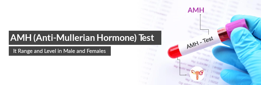 AMH (Anti-Mullerian Hormone) Test, It Range and Level in Male and Females