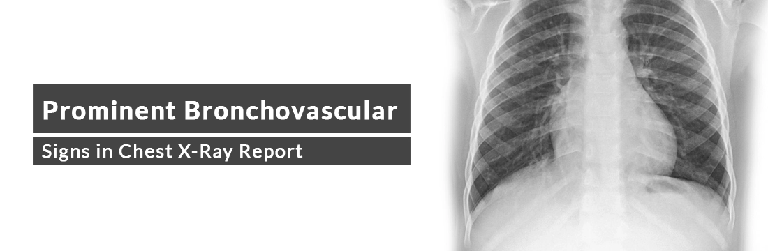 Prominent Bronchovascular Signs in Chest X-Ray Report | Ganesh Diagnostic