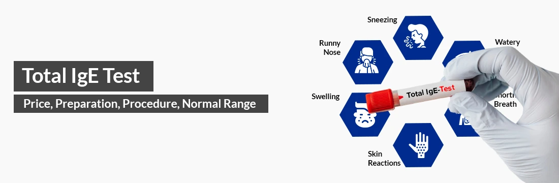 Total IgE Test : Price, Preparation, Procedure, Normal Range