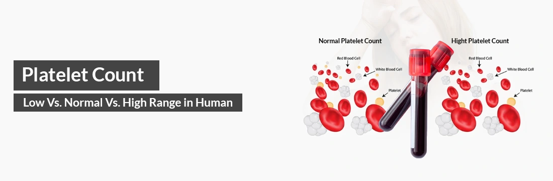 Platelet Count: Low vs. Normal vs. High Range in Human