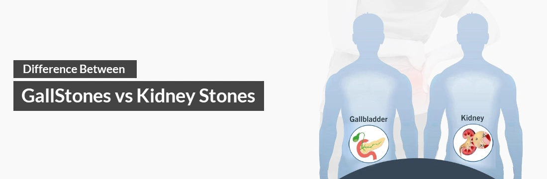 Difference Between Gall Stone vs Kidney Stone | Ganesh Diagnostic