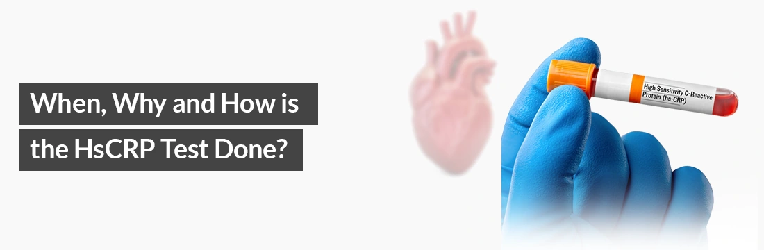 When, Why, and How is the HsCRP Test Done | Ganesh Diagnostic