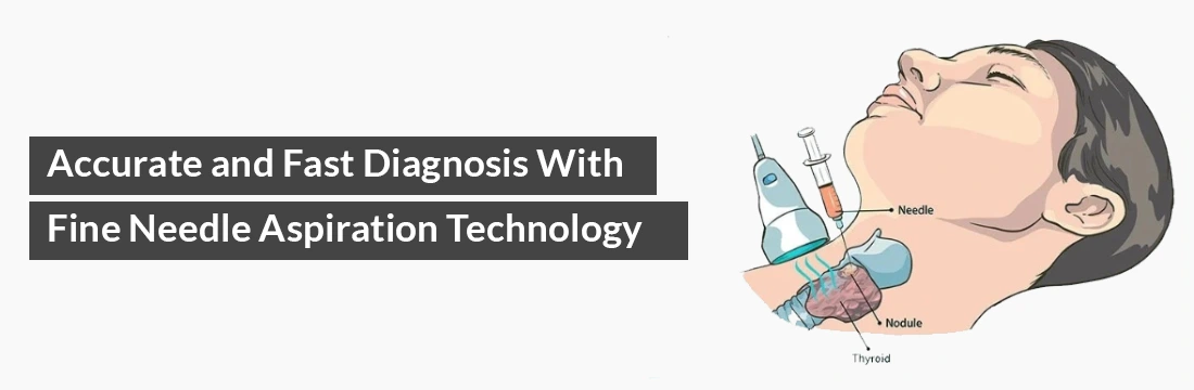 Accurate and Fast Diagnosis With Fine Needle Aspiration Technology