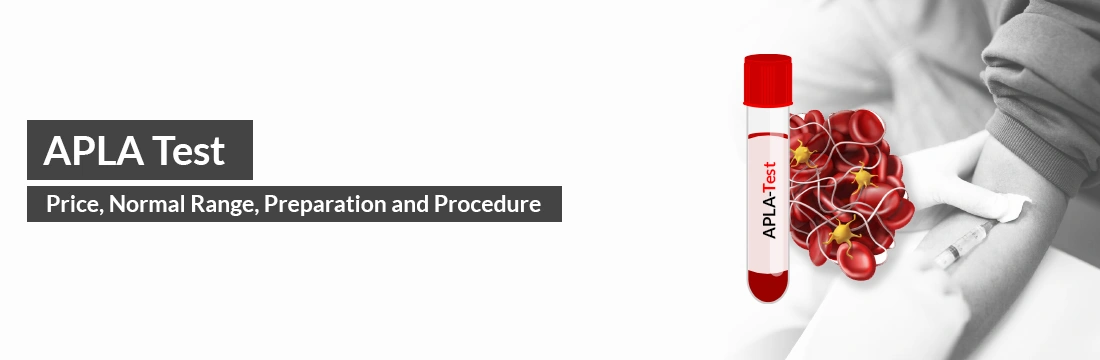APLA Test - Price, Normal Range, Preparation, Procedure | Ganesh Diagnostic