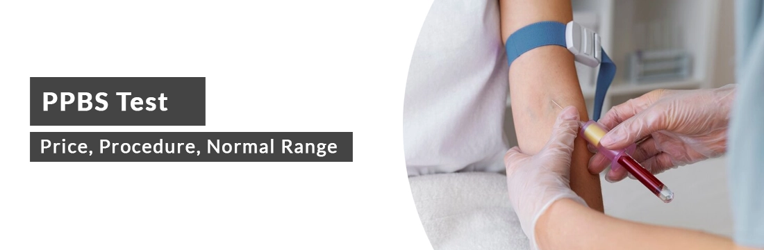 PPBS Test - Price, Procedure, Normal Range & More | Ganesh Diagnostic