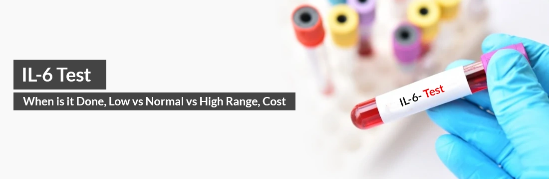 IL-6 Test: When is it Done, Low vs Normal vs High Range, Cost in India