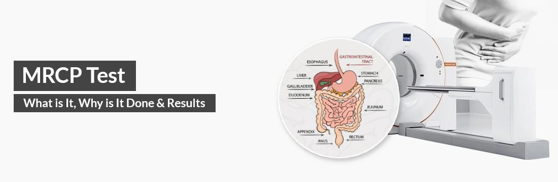 MRCP Test: What is It, Why is It Done, Results | Ganesh