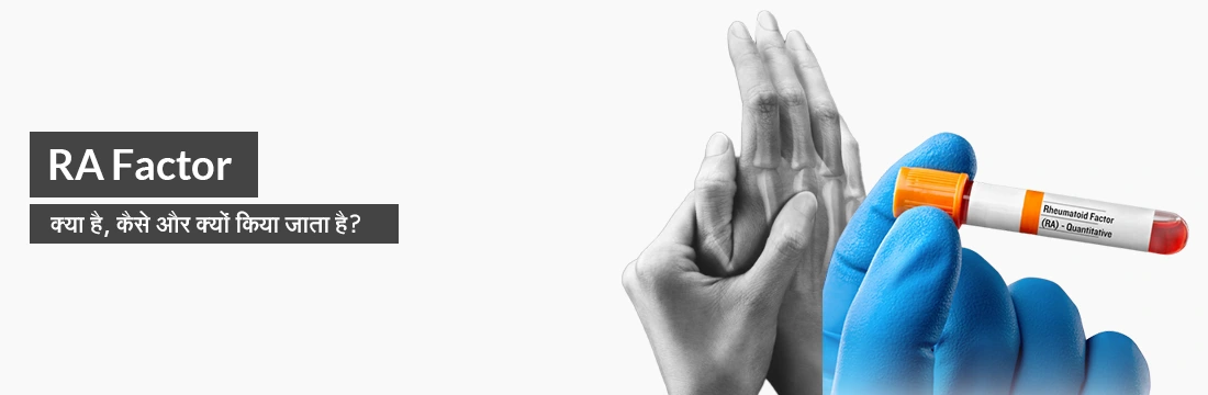 RA Factor परीक्षण: क्या है, कैसे, और क्यों किया जाता है?