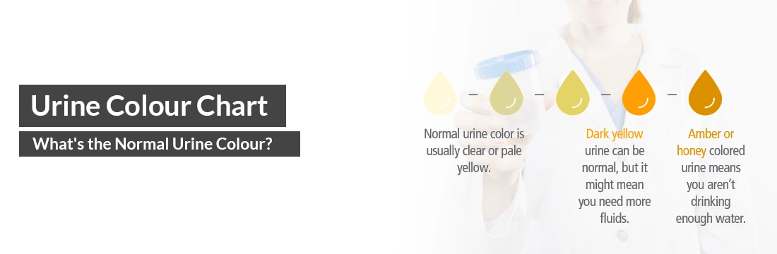 Urine Colour Chart: What's the Normal Urine Colour | Ganesh Diagnostic
