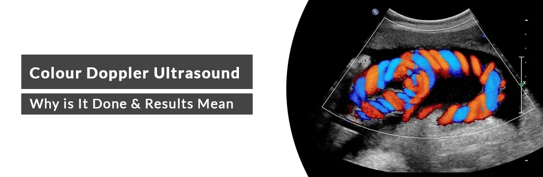 Colour Doppler Ultrasound Test During Pregnancy: Why is It Done, What ...